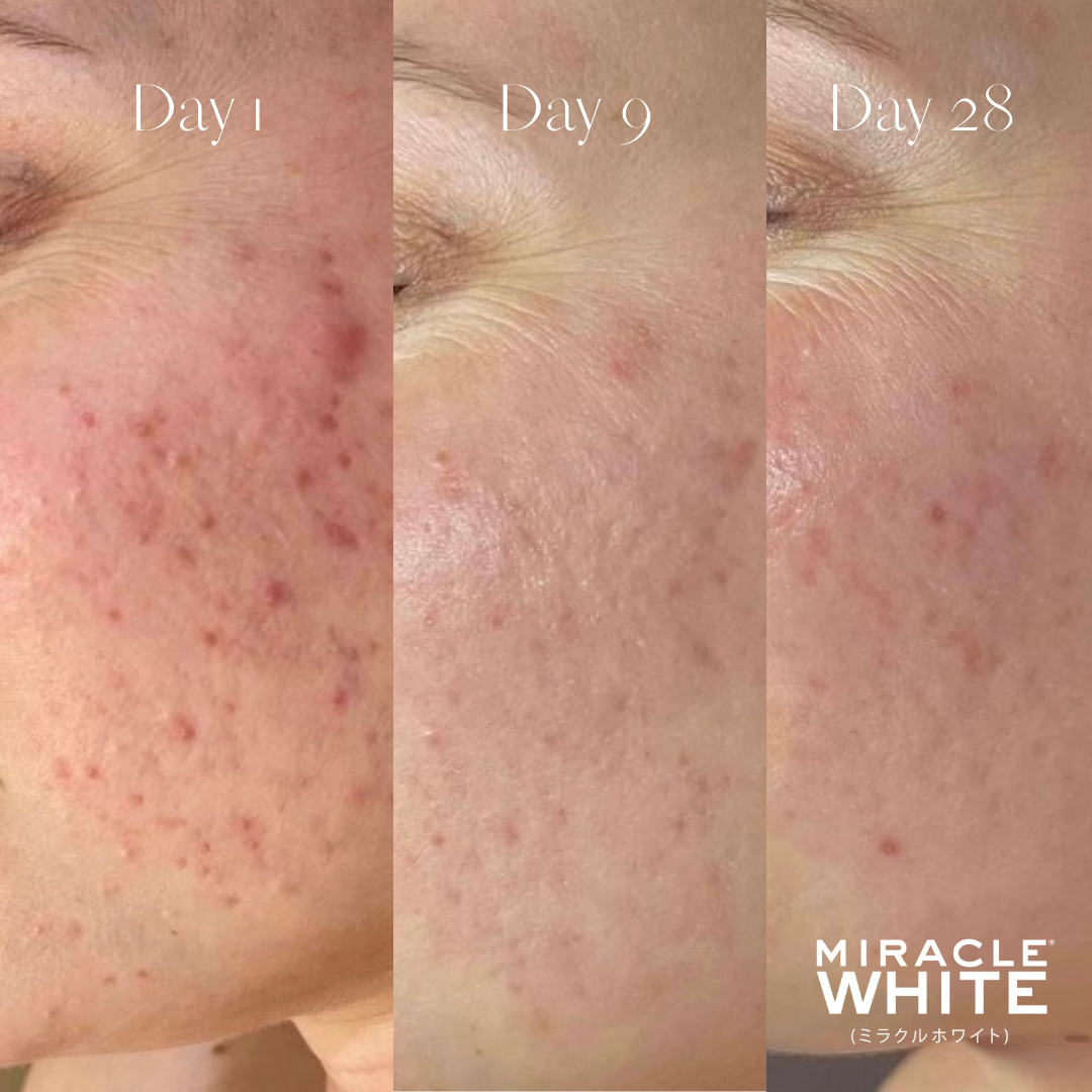 Miracle White GLOW VITAMINS®️ – Miracle White®