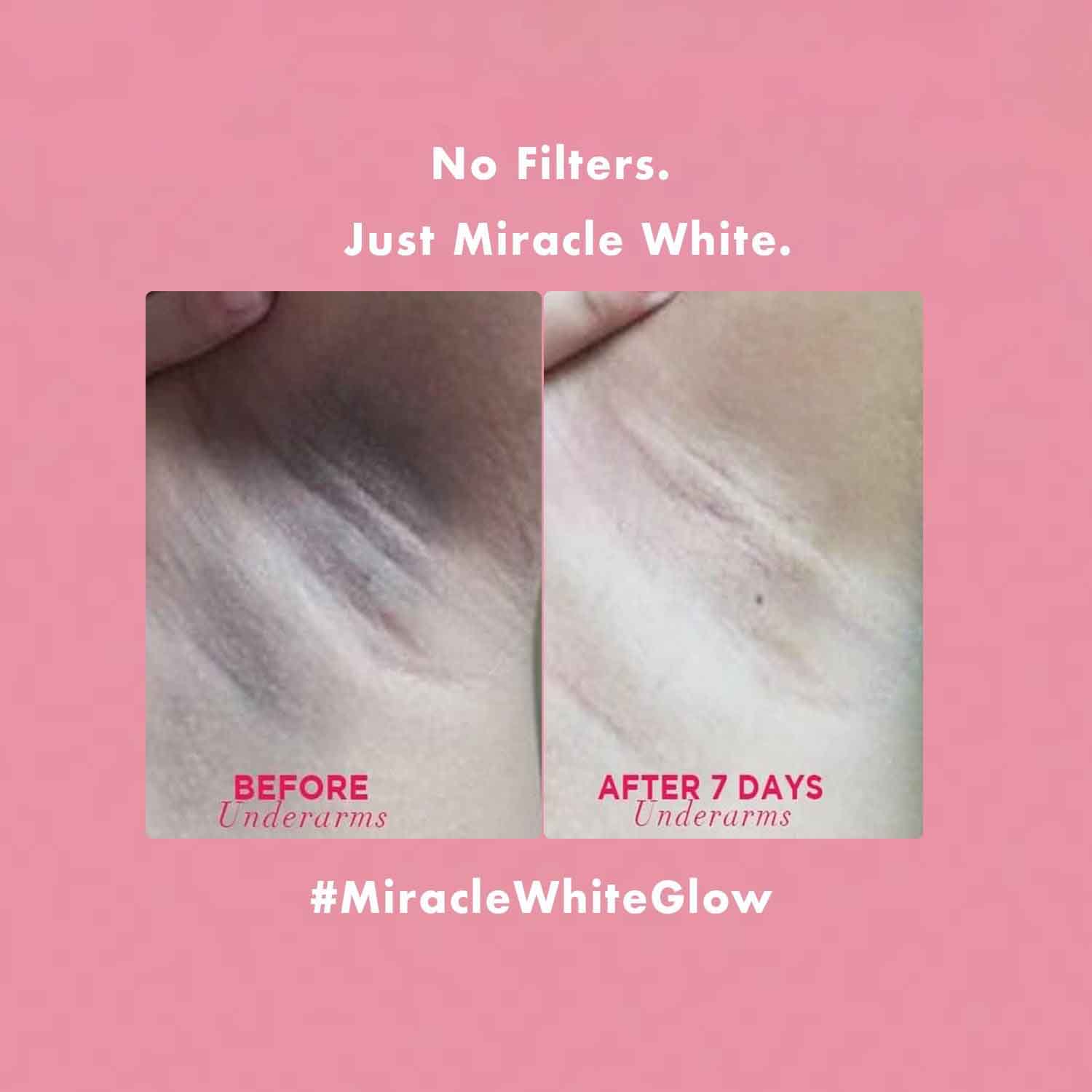 GLOW – Miracle White®